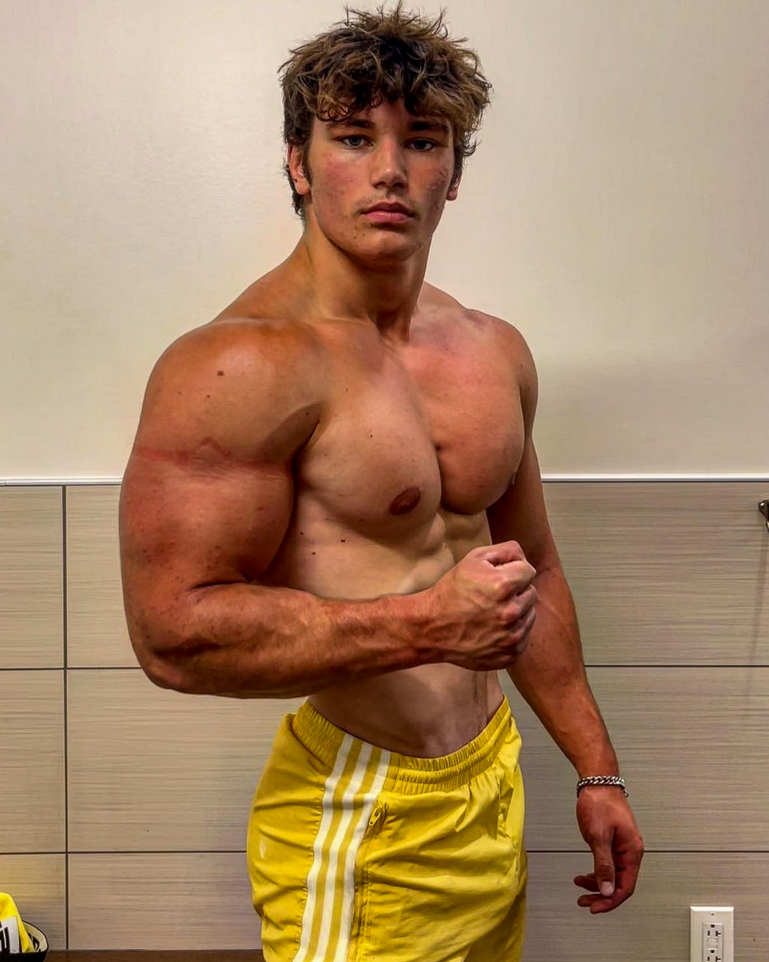 Inaugural EpicPecs Award – Best Chest of 2022 – Round I - EpicPecs